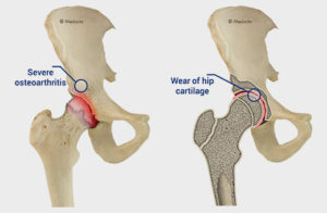 Mr David Booth - Melbourne Orthopaedic Hip and Knee Surgeon